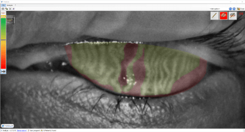 CORNEA550 Corneal Topographer - Essilor Instruments USA